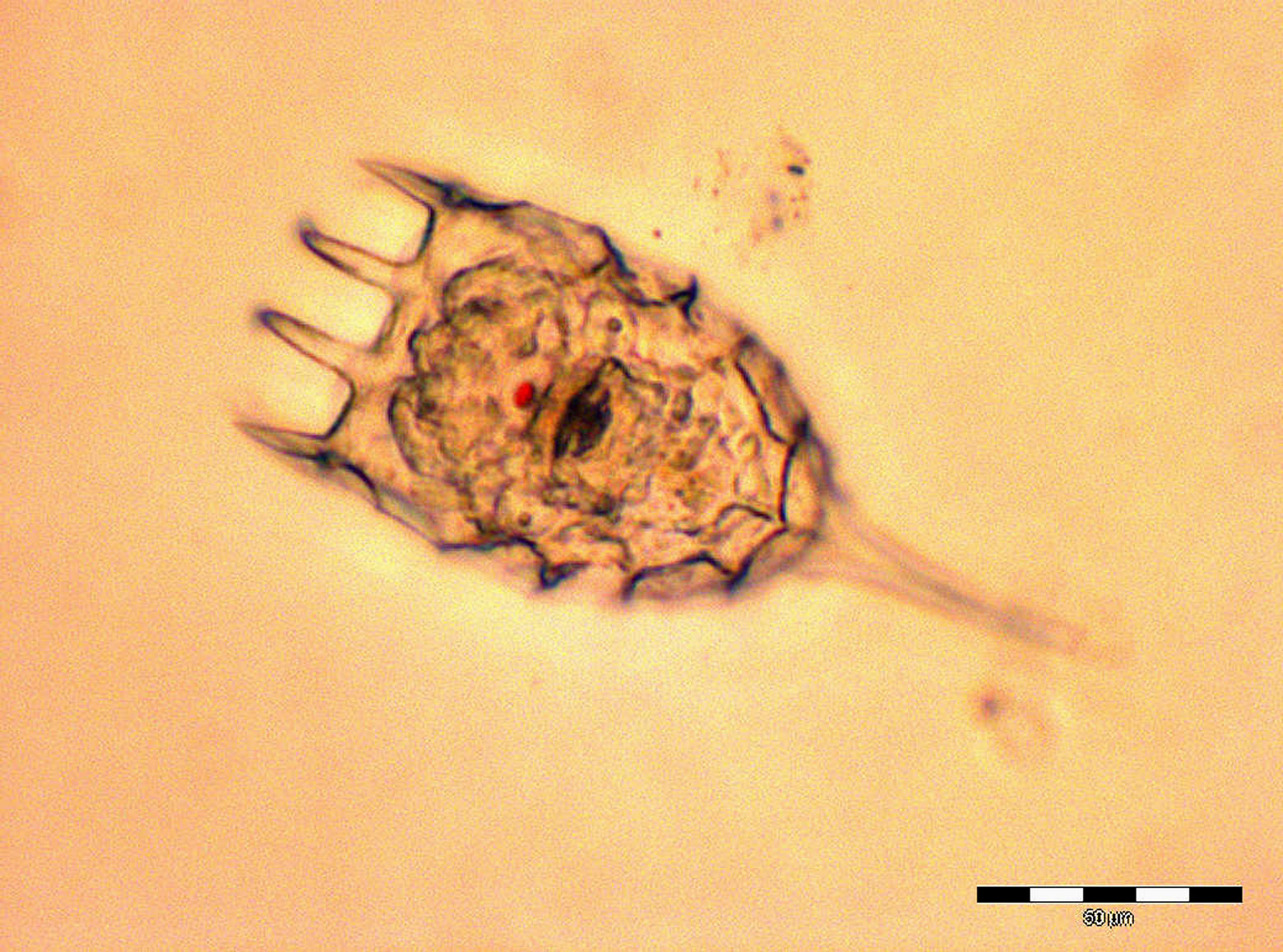 Keratella cochlearis | Universität Koblenz
