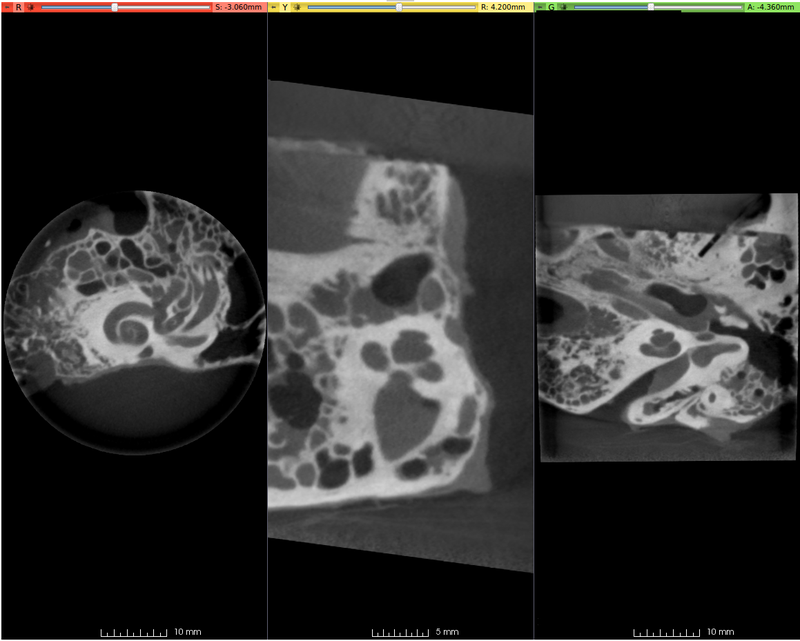 Cochlea model | University of Koblenz